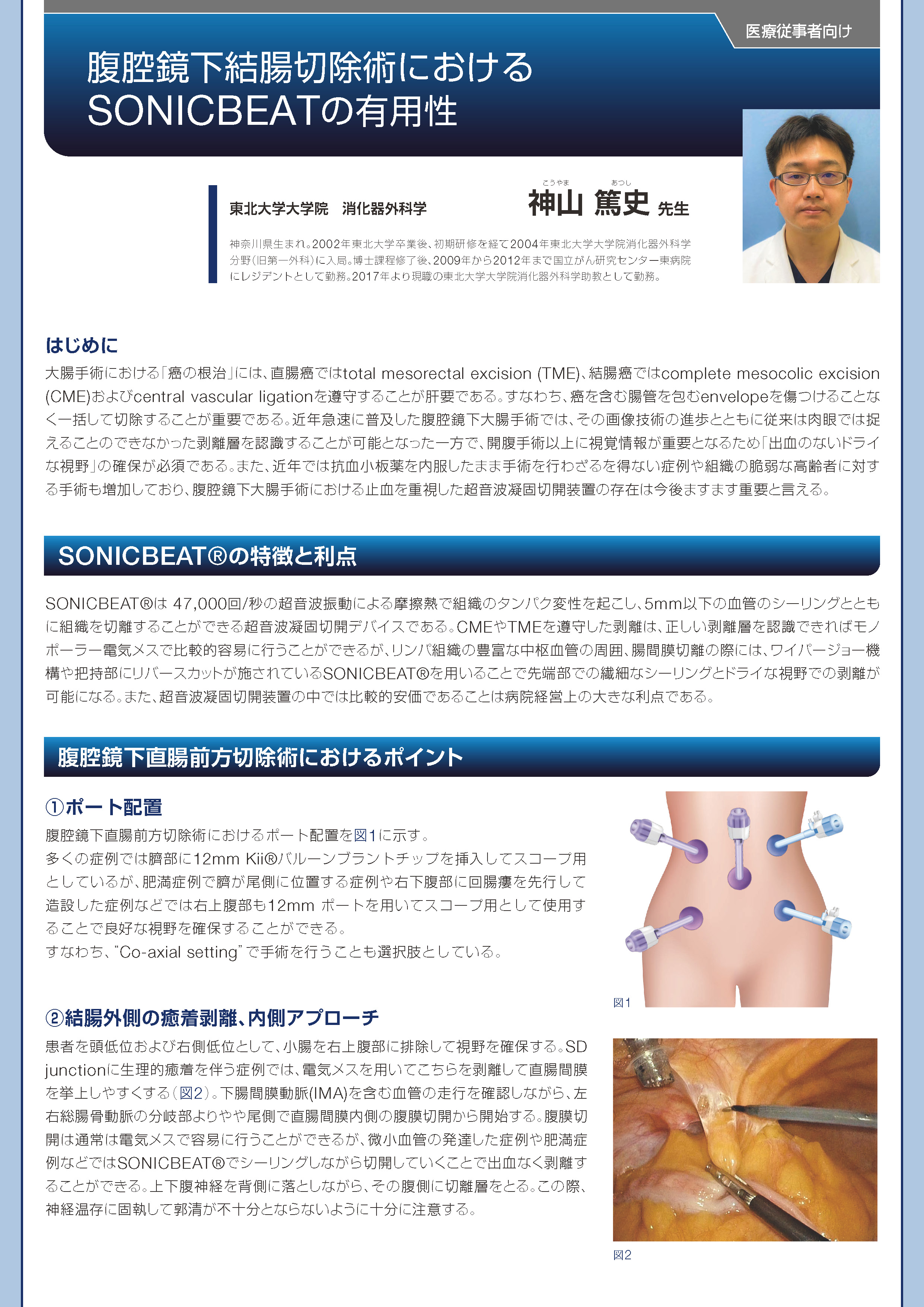 腹腔鏡下結腸切除術におけるSONICBEATの有用性|動画・レポート|オリンパス医療ウェブサイト メディカルタウン